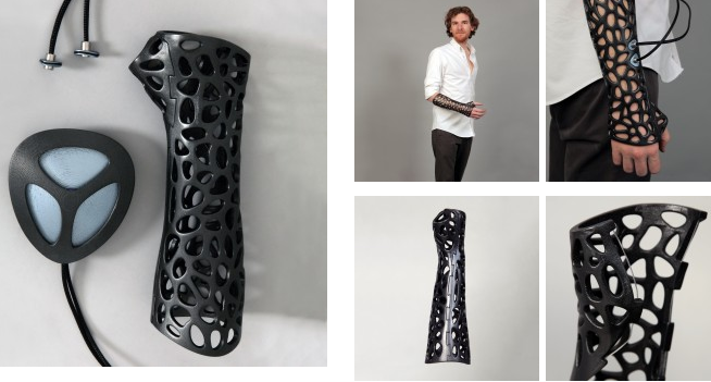 Ultrasonics and 3D printed casts can help bones and wounds heal 40-80% ...