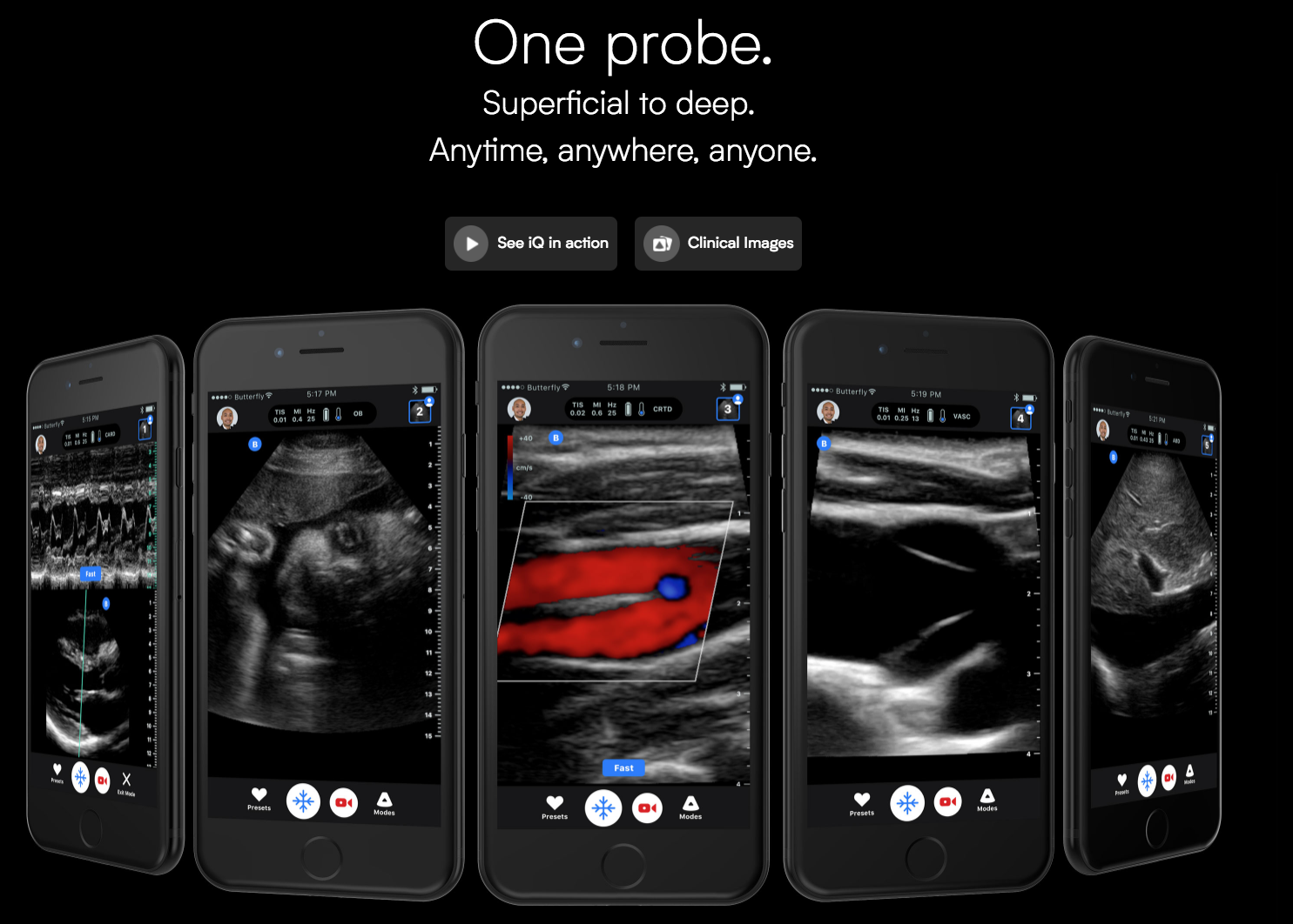 Ultrasound on a chip using an array of sensors will make ultrasound 50 ...