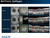 AgeX to develop powerful regenerative and anti-aging treatments ...