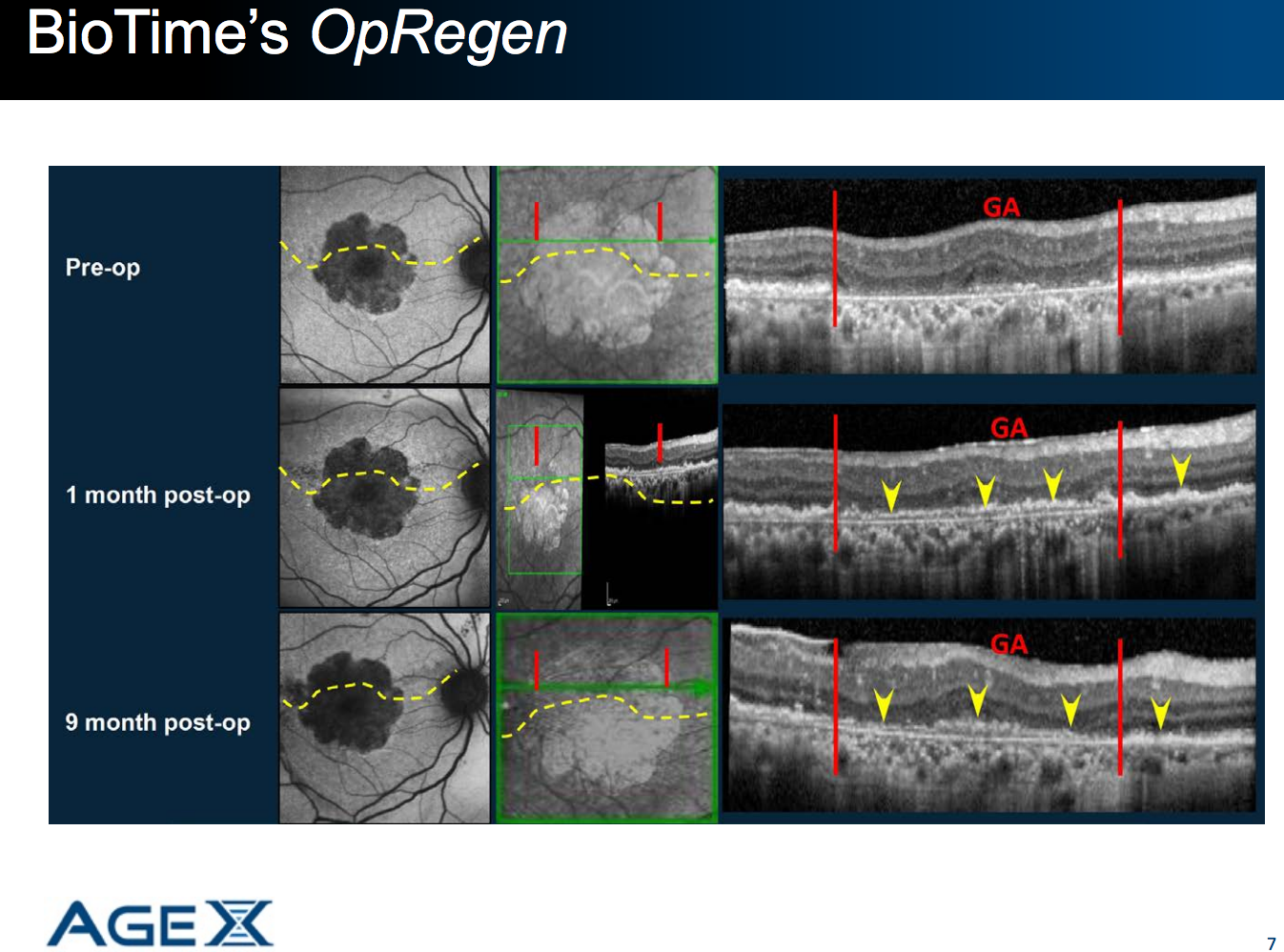 AgeX to develop powerful regenerative and anti-aging treatments ...