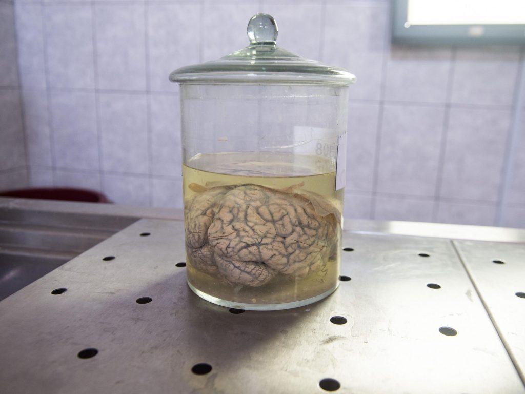 BrainEx technology kept hundreds of pig brains alive outside of bodies ...