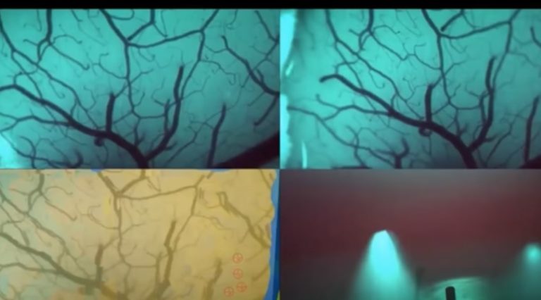 Neuralink and Elon Musk Have 10,000 Electrode-Thread Brain Computer ...