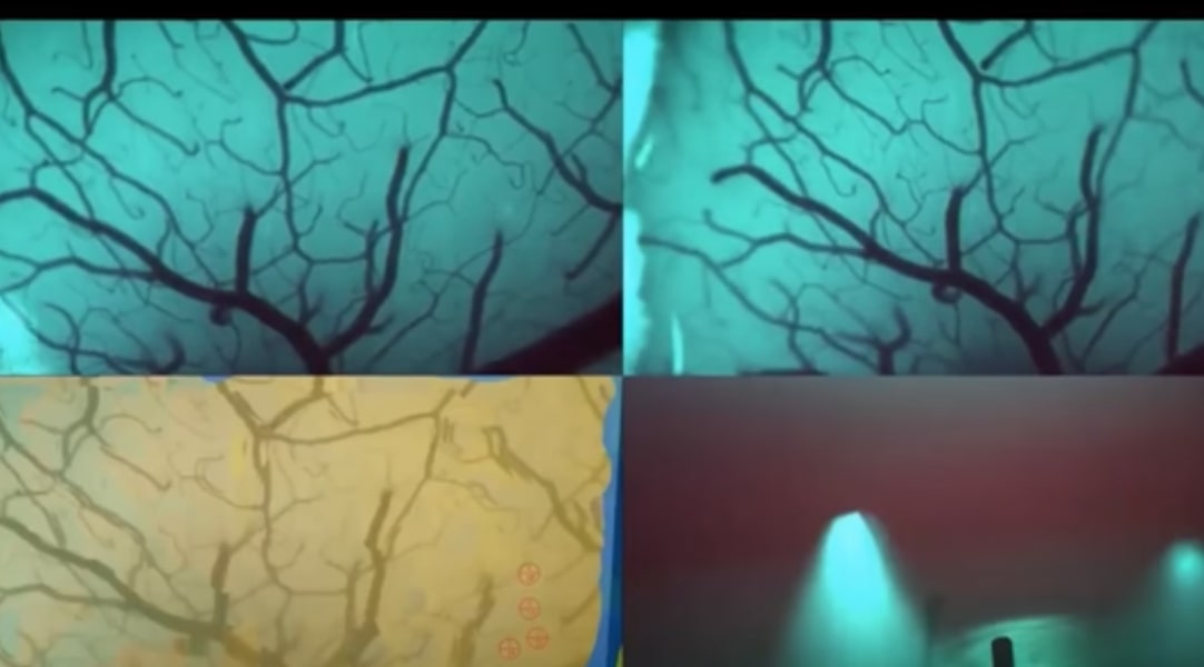 Neuralink and Elon Musk Have 10,000 Electrode-Thread Brain Computer ...