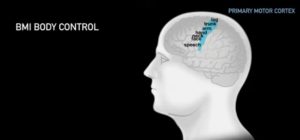 Neuralink Multi-thousand Channel Brain Interface Implantation Surgery ...