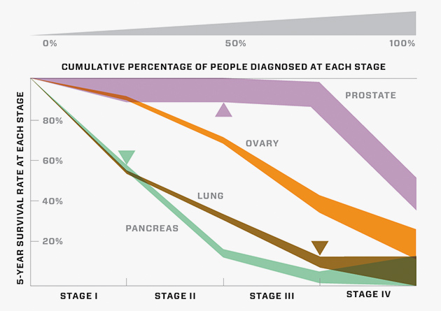 AI, Genome Sequencing and New Sensors Creates Pre-Cancer Management ...