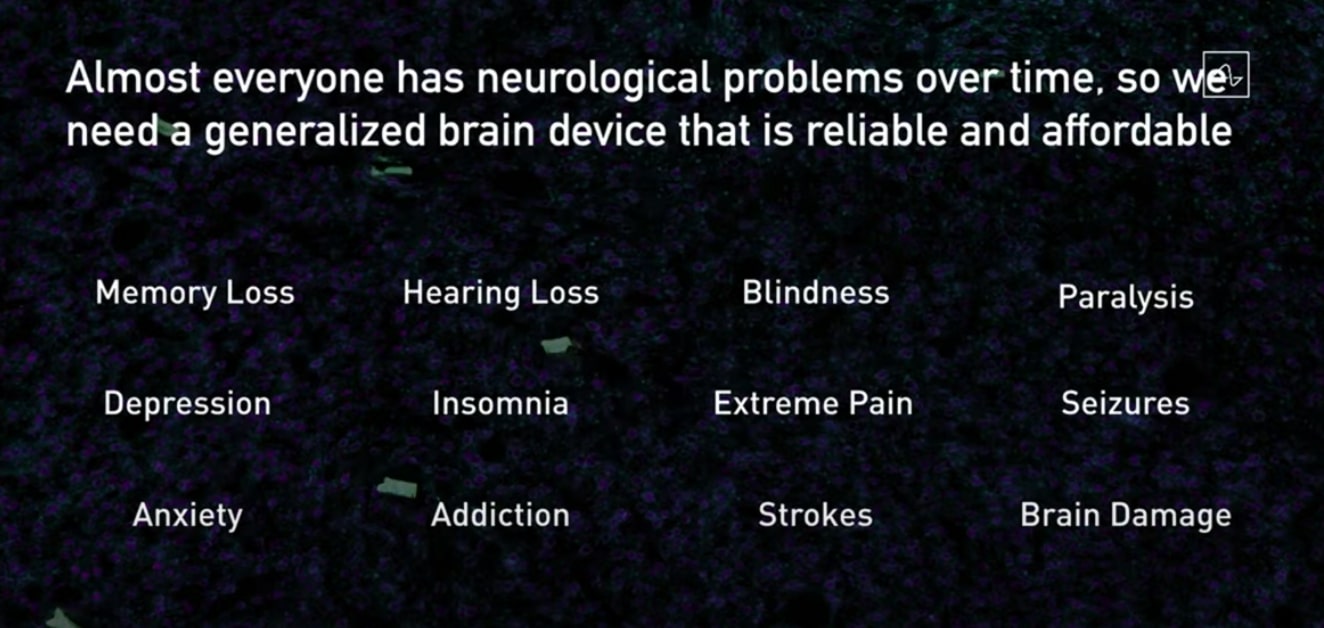 Neuralink is a Fitbit in Your Skull With Tiny Wires to Fix Your Brain ...