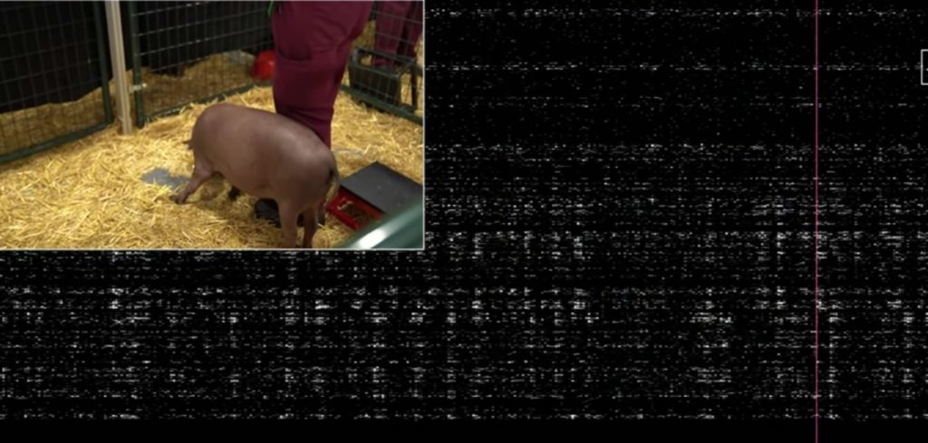 Neuralink is a Fitbit in Your Skull With Tiny Wires to Fix Your Brain ...