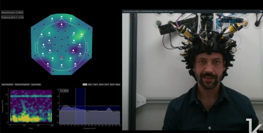 Better Brain Interfaces Are Like Internet Shifting From Dial-Up to ...