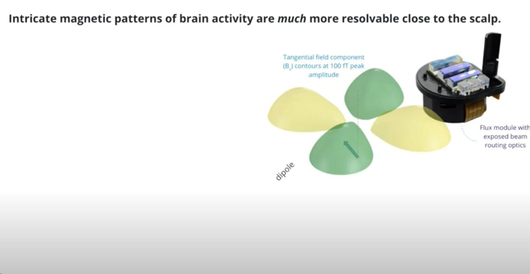 Better Brain Interfaces Are Like Internet Shifting From Dial-Up to ...