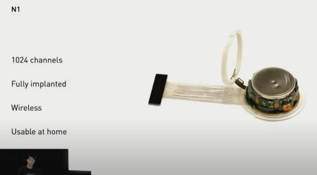 Neuralink Day Highlights a Brain Implant With Over 4000 Channels | NextBigFuture.com