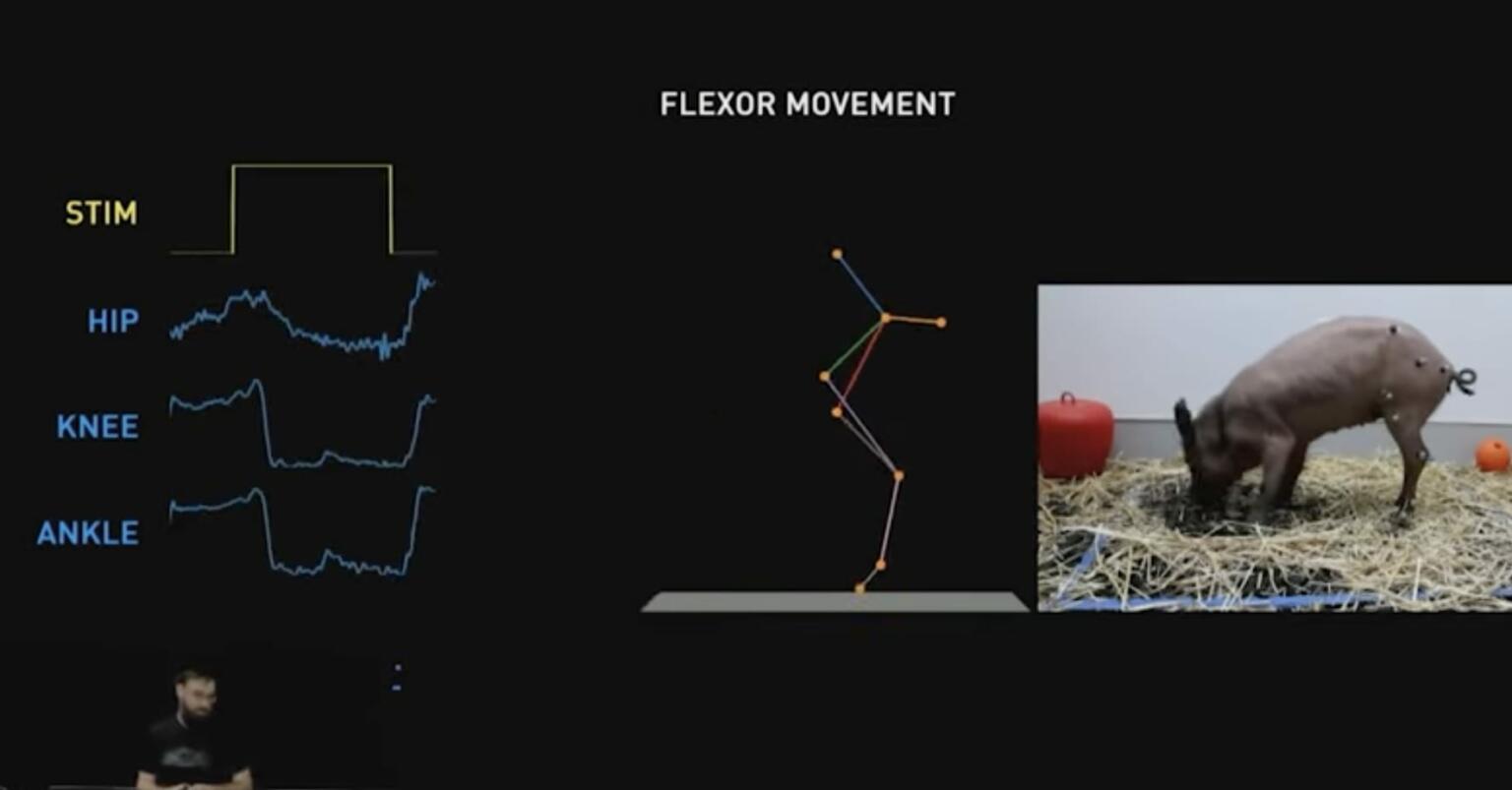 Neuralink Day Highlights a Brain Implant With Over 4000 Channels ...