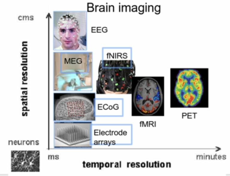 Kernel Brain Computer Interface and General BCI Technology Overview ...