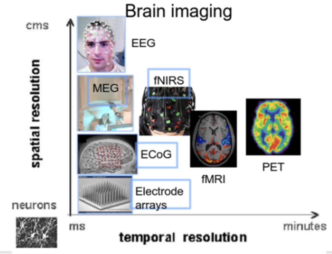 Kernel Brain Computer Interface and General BCI Technology Overview ...