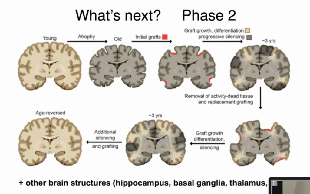 Progressive Brain Tissue Replacement Jean Hebert | NextBigFuture.com