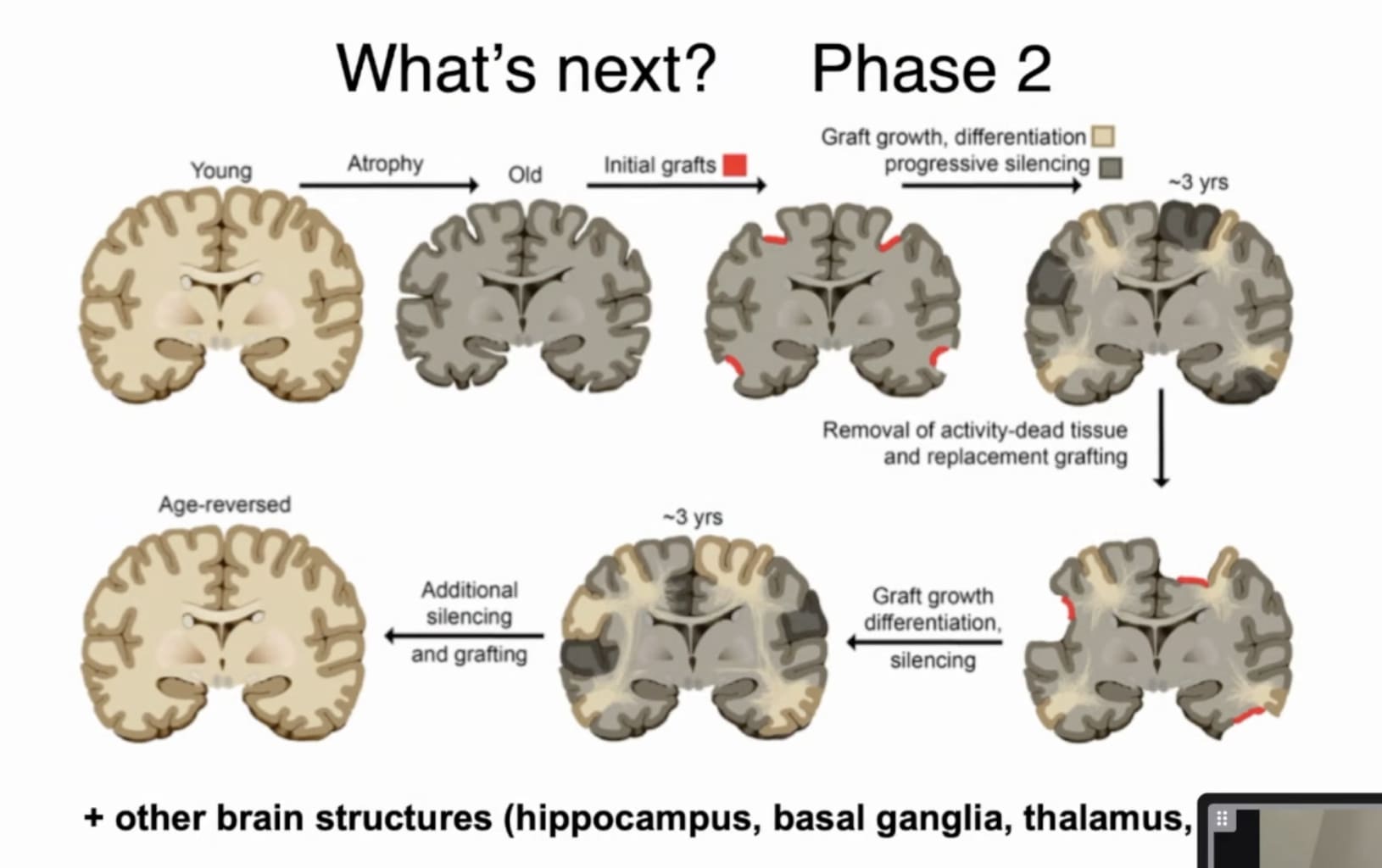 Progressive Brain Tissue Replacement Jean Hebert | NextBigFuture.com