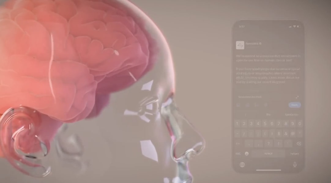 The First Human Has Gotten a Neuralink Implant | NextBigFuture.com