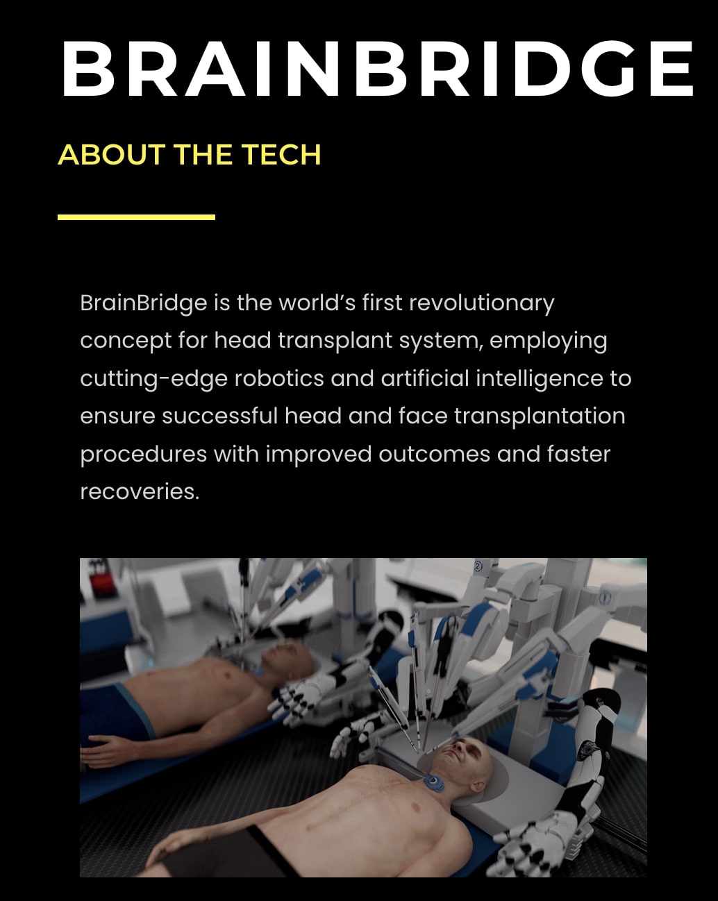 New Startup Brainbridge Wants to Perform Head Transplants | NextBigFuture.com