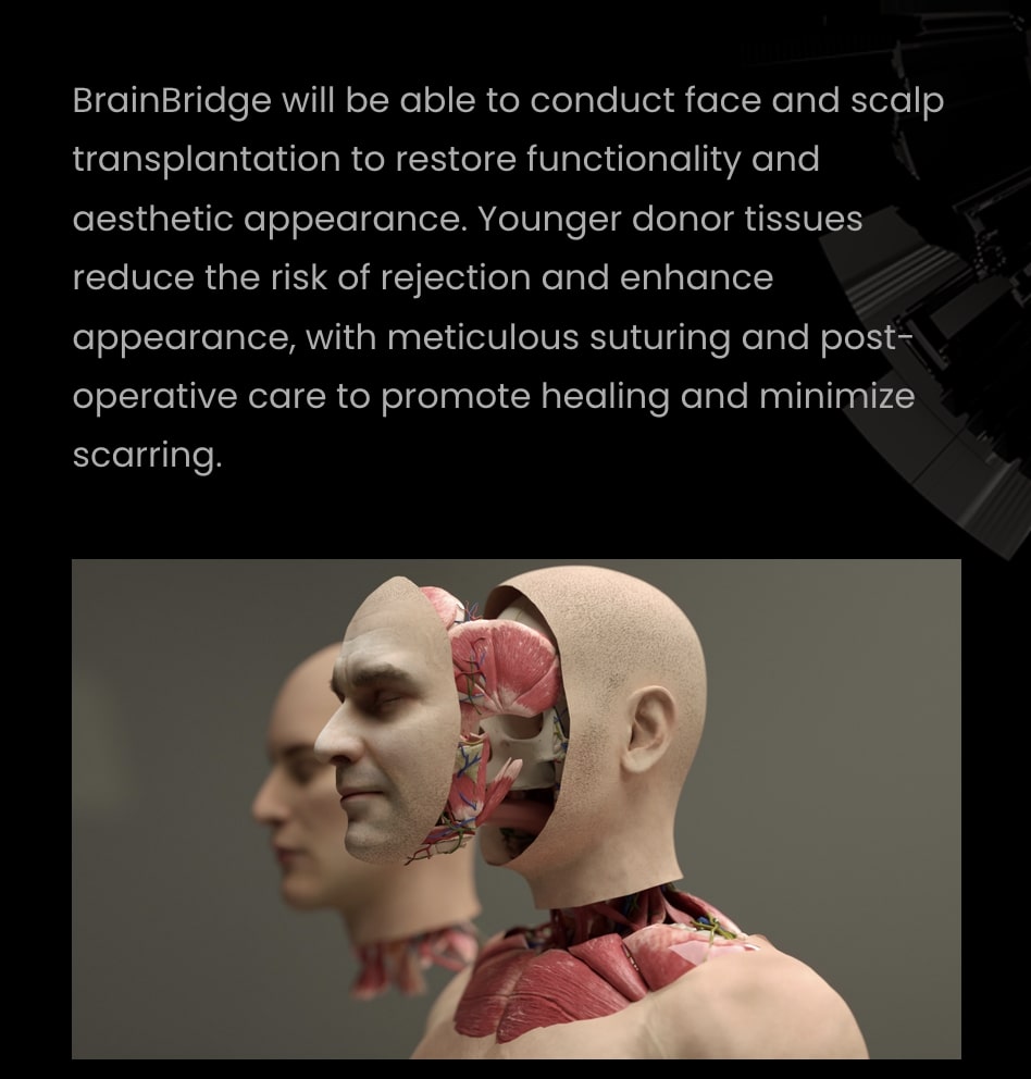 New Startup Brainbridge Wants to Perform Head Transplants | NextBigFuture.com