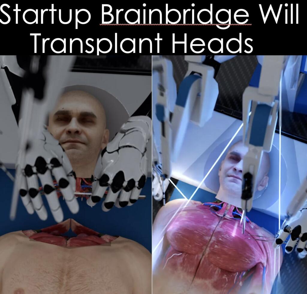 New Startup Brainbridge Wants to Perform Head Transplants ...